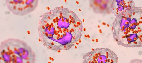 Povišeni leukociti - koje su normalne vrijednosti i uzrok?